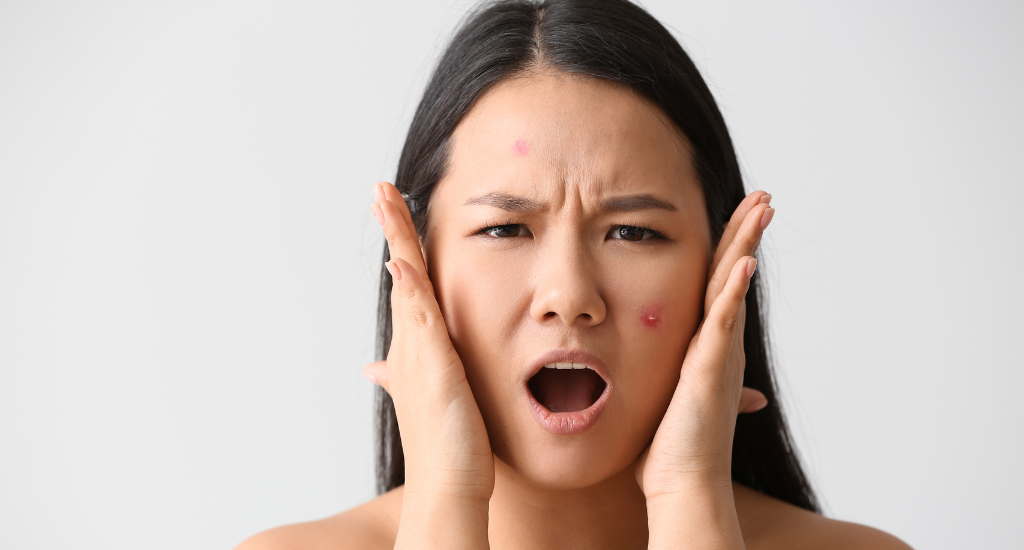 The Effects of Stress on Skin